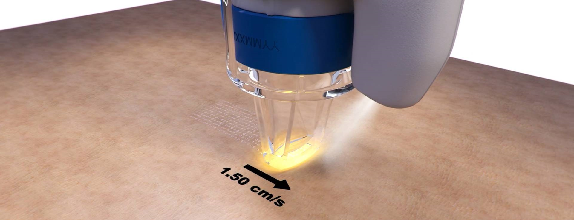 Skin Resurfacing – BIOLASE Store